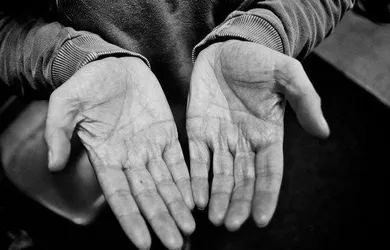 Perceraiannya dengan dr Tirta Sempat Disembunyikan, Inilah Medisca ...