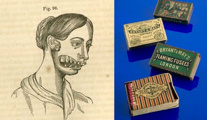 Apa itu Senjata Bom Fosfor dan Mengapa Penggunaannya Dikecam ...