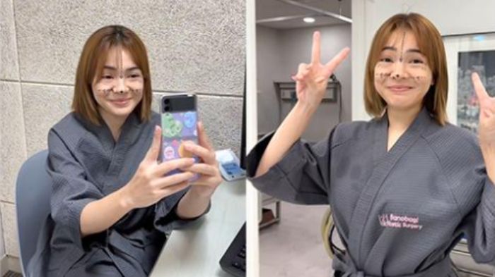 Maya Septha Operasi Plastik, Bak Ganti Wajah, Pangling Banget!