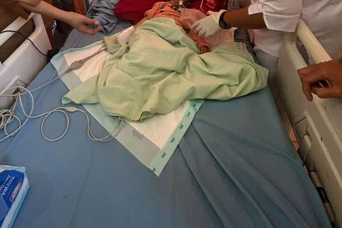 Kronologi Balita di Bengkulu Muntah Cacing dari Mulut dan Hidung, Mirip Kasus Raya Sukabumi, Apa ...