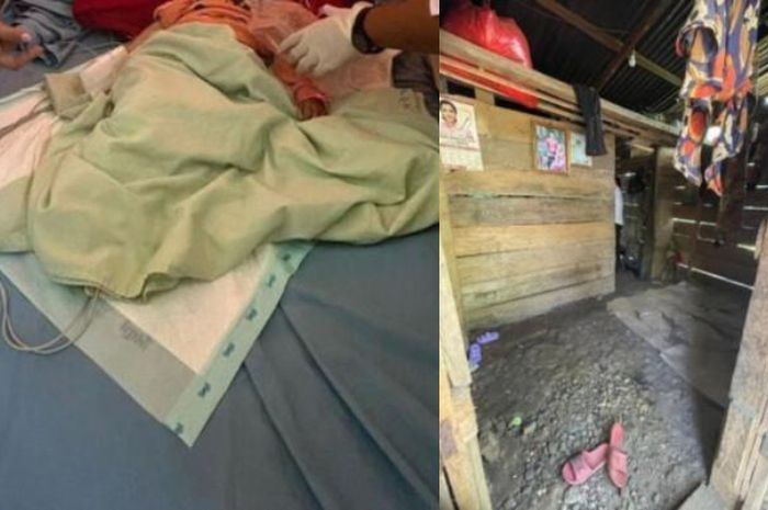 Kronologi Balita di Bengkulu Muntah Cacing dari Mulut dan Hidung, Mirip Kasus Raya Sukabumi, Apa ...