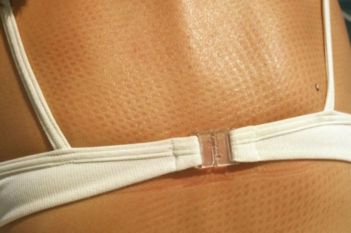 Bagaimana Perubahan Iklim Makin Memperburuk Kondisi Kulit Anda? - Semua ...