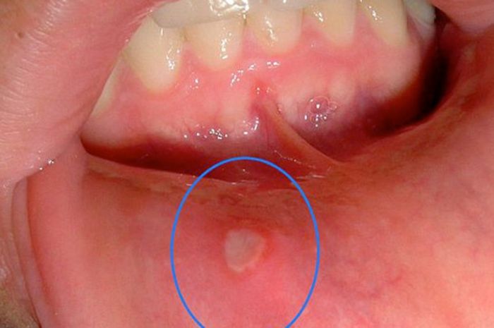 Petunjuk Mengidap Penyakit Terlihat dari Lidah - National Geographic