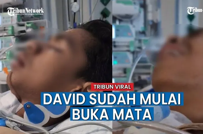 Jonathan Latumahina Ungkap Kondisi Terbaru Sang Anak Setelah Siuman ...