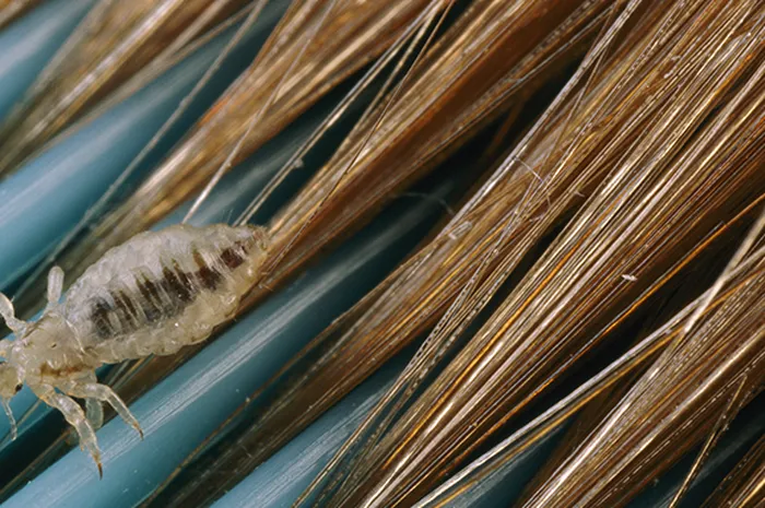 Mitos Tentang Kutu Kepala