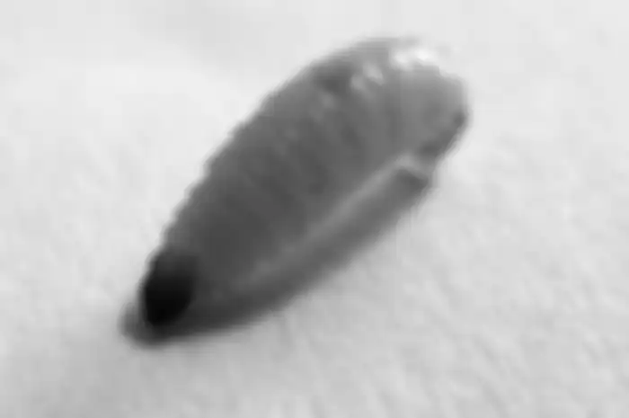 Video Viral Belatung TikTok Full yang Bikin Geli dan Merinding - Page 4