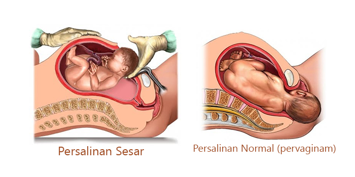 proses persalinan normal ppt