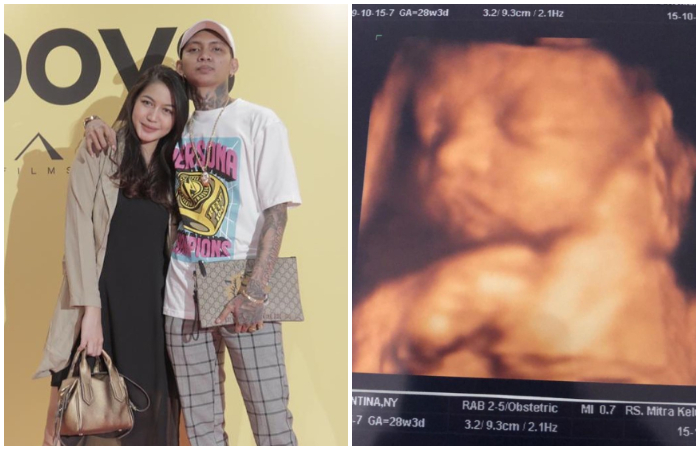 Pamer Foto Hasil USG Kekasih, Young Lex Udah Nggak Sabar Jadi Ayah Baru