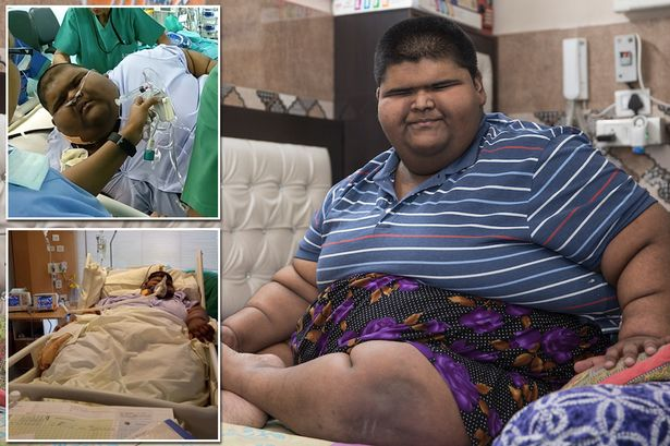 Kisah Mihir Jain, Jadi Anak Terberat di Dunia dengan Bobot Mencapai 200 ...