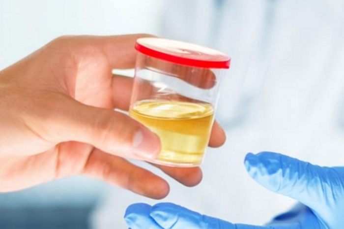 Sering Diabaikan, Urin yang Berbusa Ternyata Jadi Tanda Penyakit Serius ...