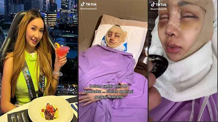Sampai Tak Bisa Dikenali, Begini Wajah Baru Lucinta Luna Setelah Nekat ...