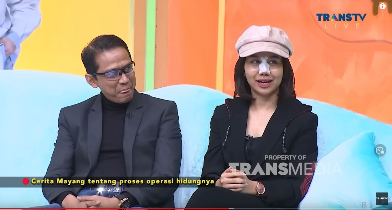 Mayang Tampil Beda Pasca Operasi Hidung, Doddy Sudrajat Diduga Jadikan ...
