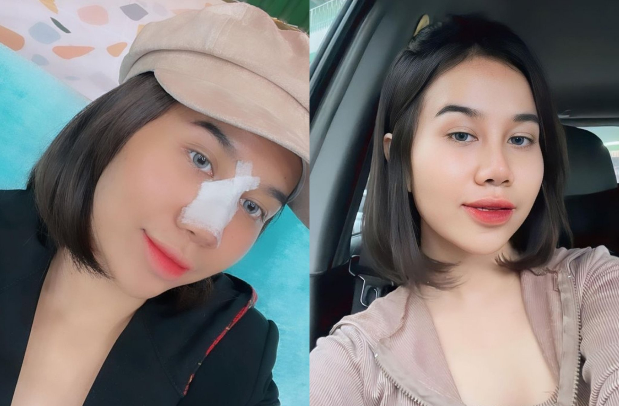 Rogoh Kocek Puluhan Juta Demi Permak Penampilan Wajah, Mayang Ngaku Lakukan Hal ini pada Dokter ...