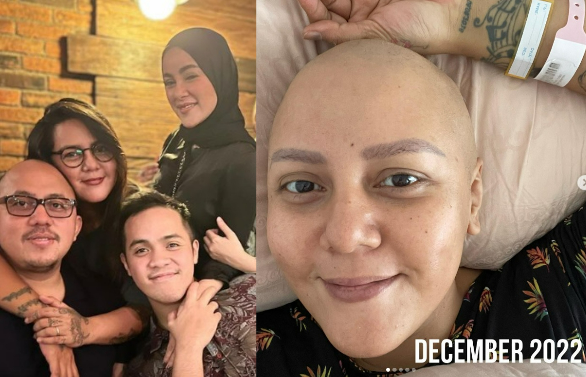Cinta Ramlan Pilu Idap Kanker Ganas, Adik Olla Ramlan Kini Tampil Botak ...