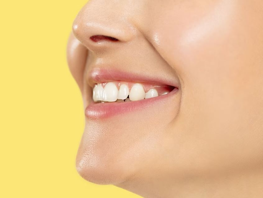 Tips Kesehatan, Begini 7 Cara Mudah Agar Gigi Gak Kuning Lagi, Dijamin ...