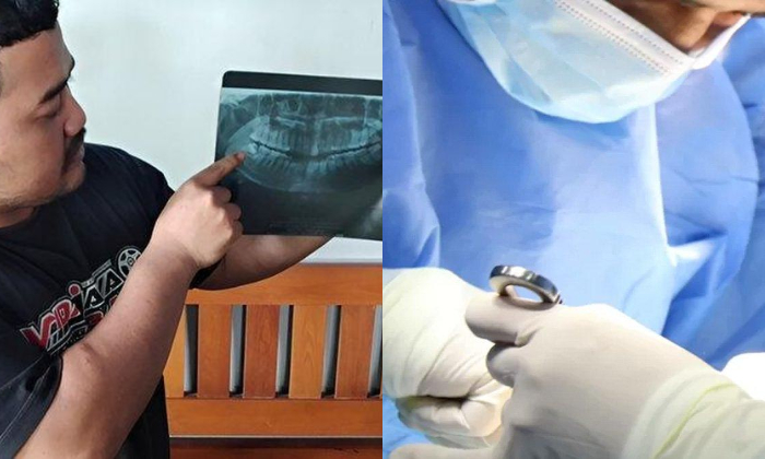 Viral Wanita Ngawi Meninggal Dunia usai Cabut Gigi Bungsu, Nasib Dokter Klinik yang Menangani ...