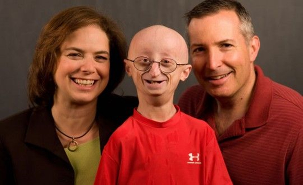 6 Hal yang Harus Diketahui dari Sam Berns yang Menderita Penyakit ...