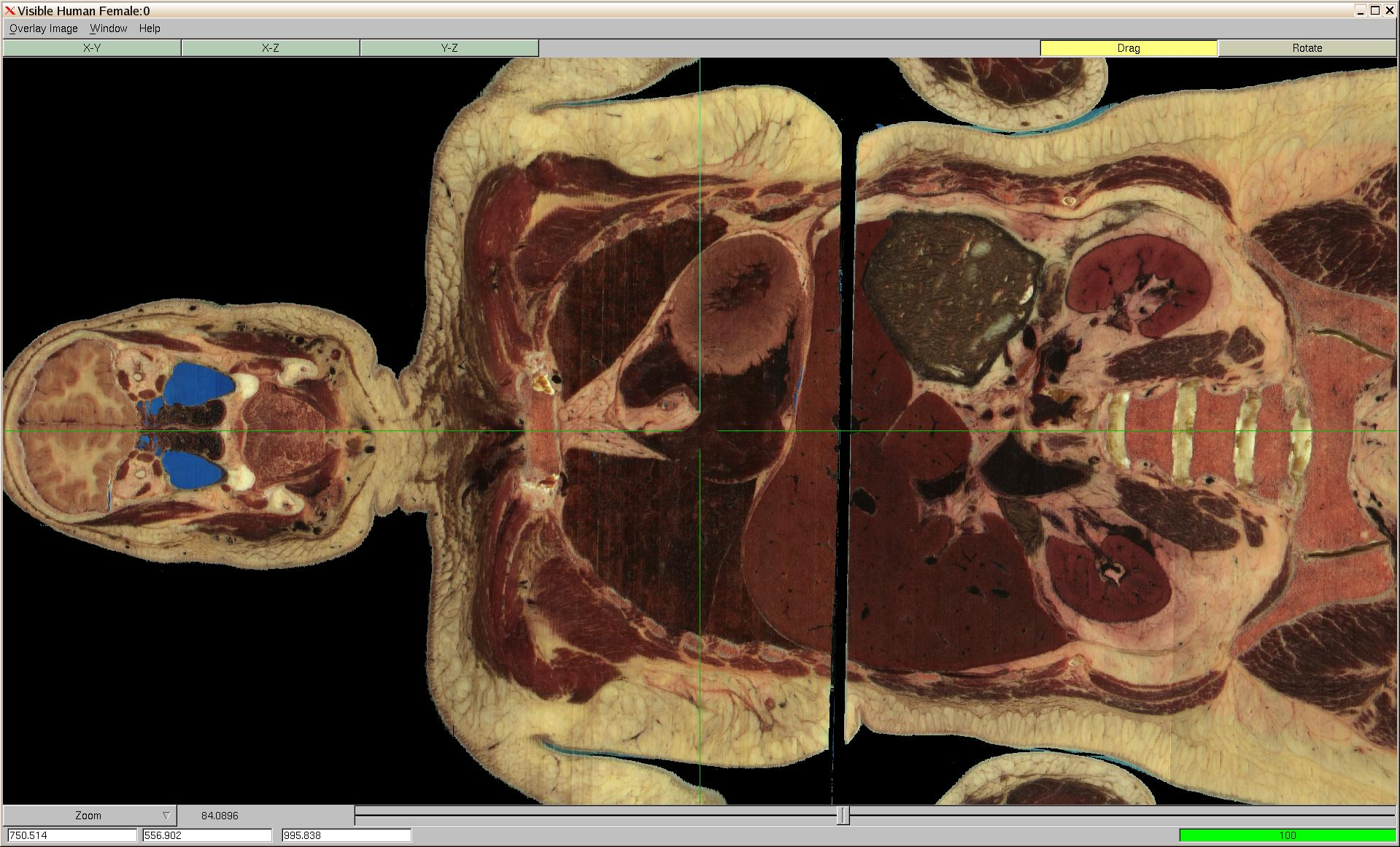Visible Human Project: Saat Ilmuwan Bangun Manusia Virtual dari 5 Ribu ...