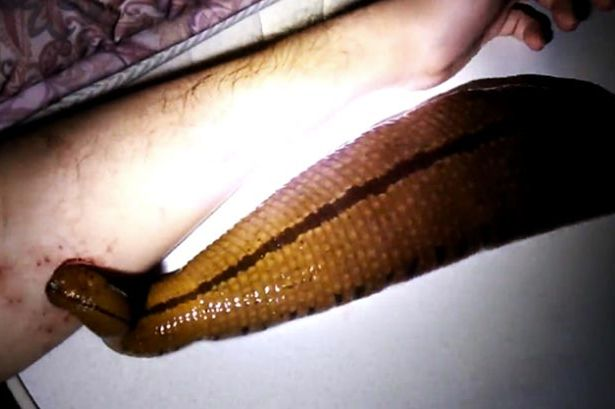 Lintah Raksasa yang Dijadikan Hewan Peliharaaan Ini Dibiarkan Menghisap Darah Tuannya