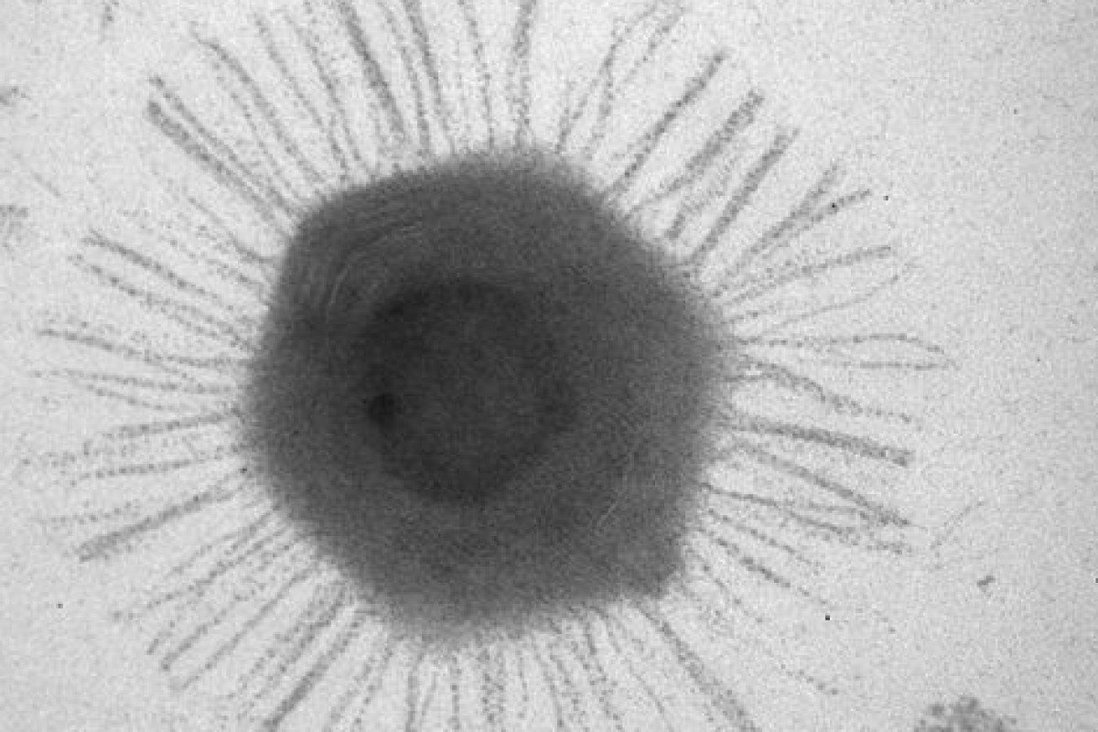 Ditemukan Dekat Dengan Tempat Terdalam di Bumi, Virus Raksasa Ini ...