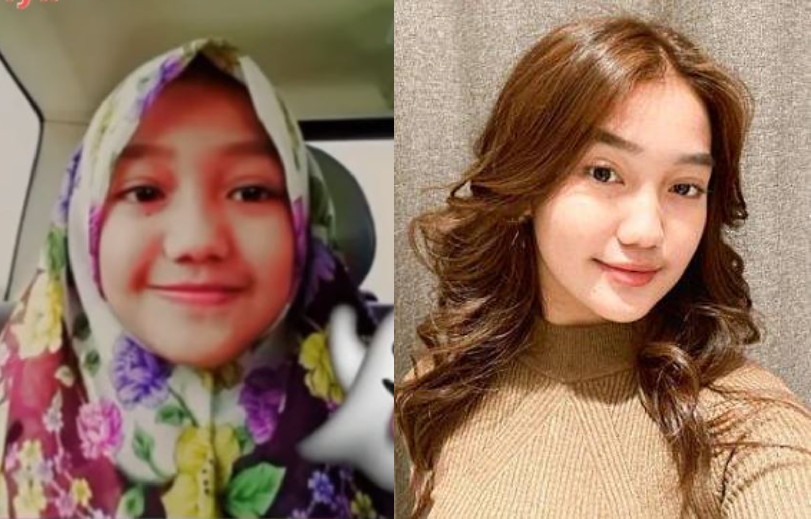 'Duit Merubah Segalanya', Beredar Foto-foto Chandrika Chika Sebelum ...