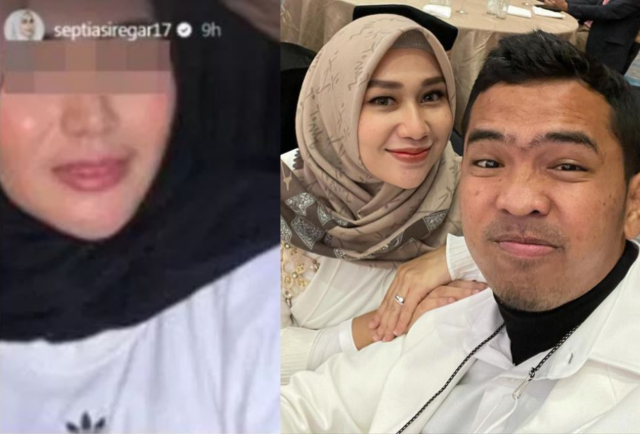 Sosok Isti yang Diduga Jadi Selingkuhan Putra Siregar, Septia Yetri Opani Unggah Foto dan ...
