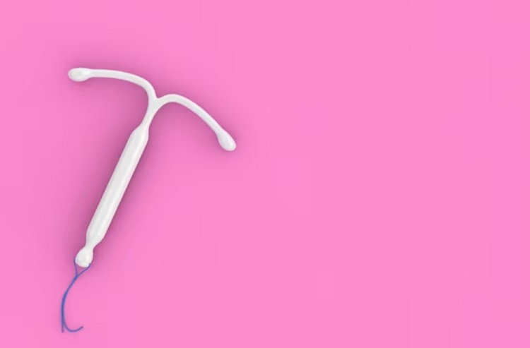 Biaya Lepas KB IUD Pakai Benang, di Puskesmas dan Klinik Harganya Beda ...