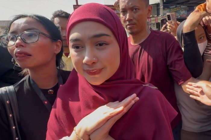 Ria Ricis Akhirnya Ungkap Alasan Oplas Hidung, Alami Kondisi Ini Selama ...